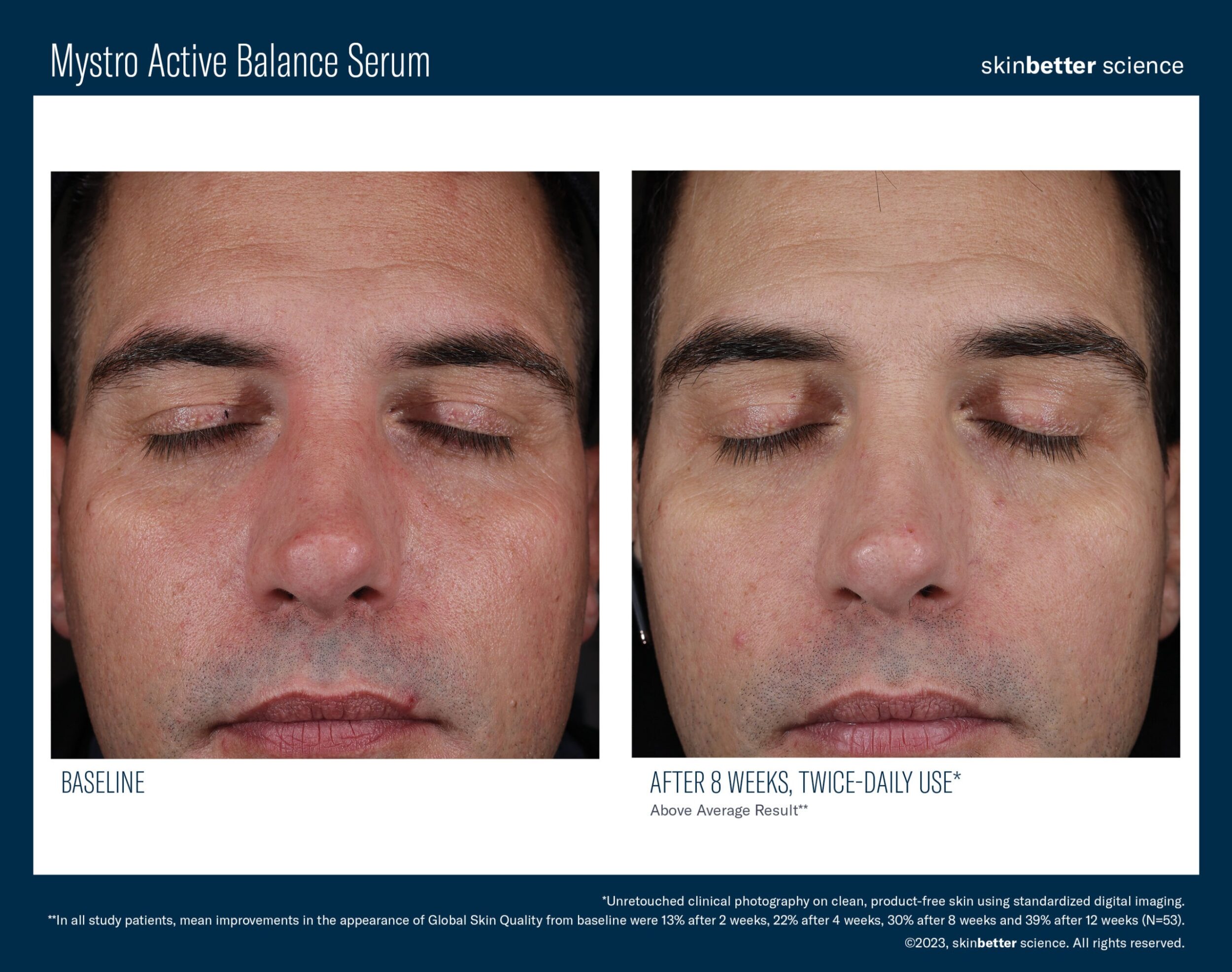 Skinbetter Mystro Active Balance Serum 1 fl oz is On Sale!