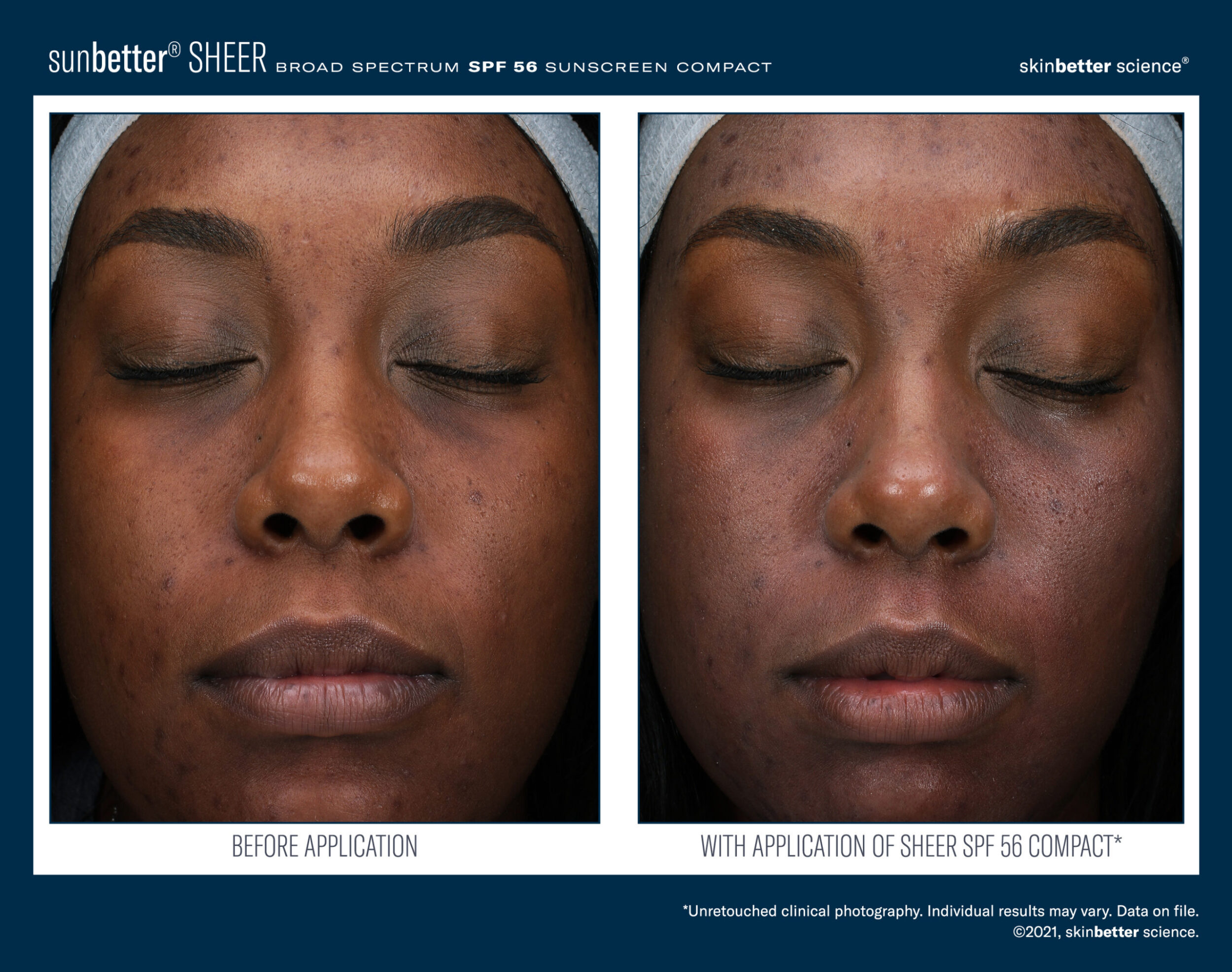 Skinbetter sunbetter SHEER SPF 56 Sunscreen Compact On Sale!